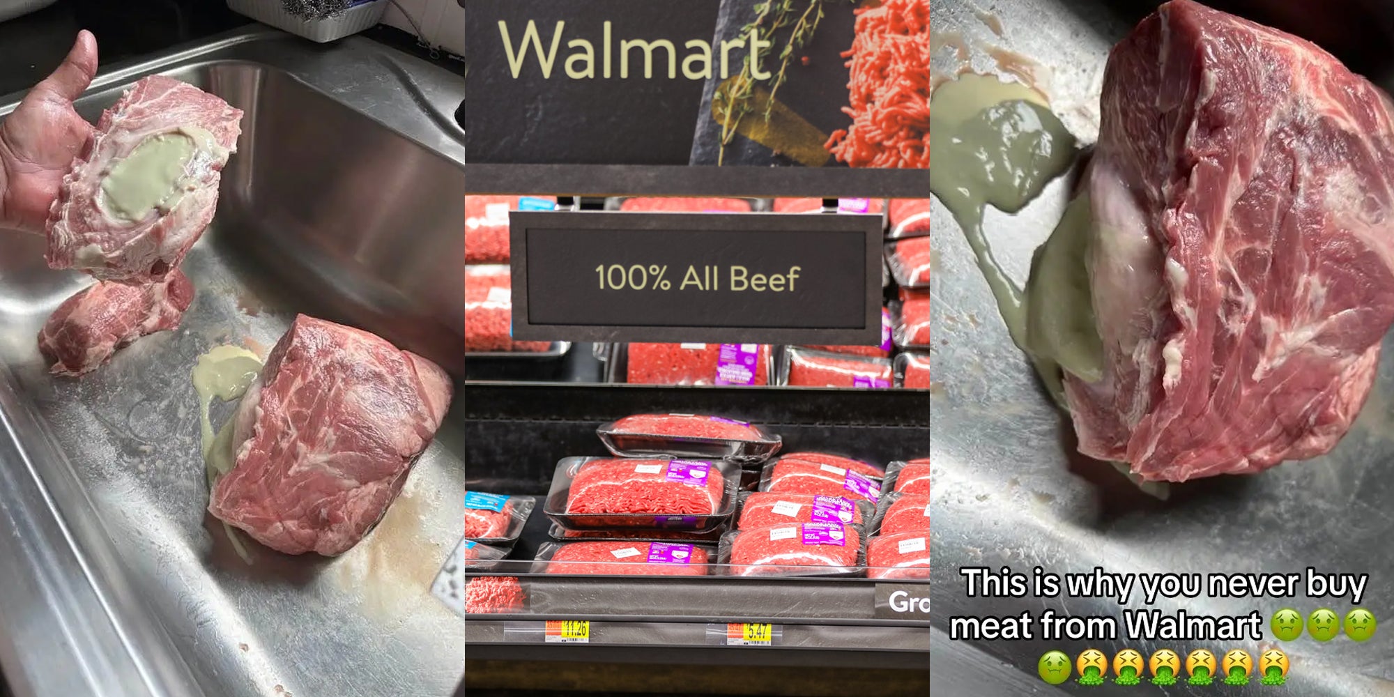 Walmart Customer Found Ruptured Cyst in Meat Purchased There