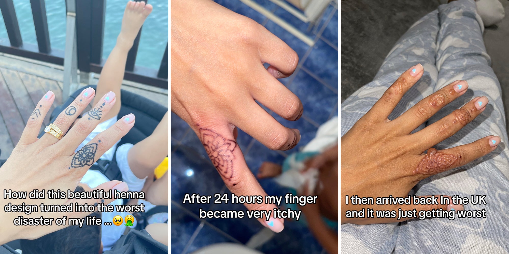Why You Shouldn't Get a Henna Tattoo While on Vacation