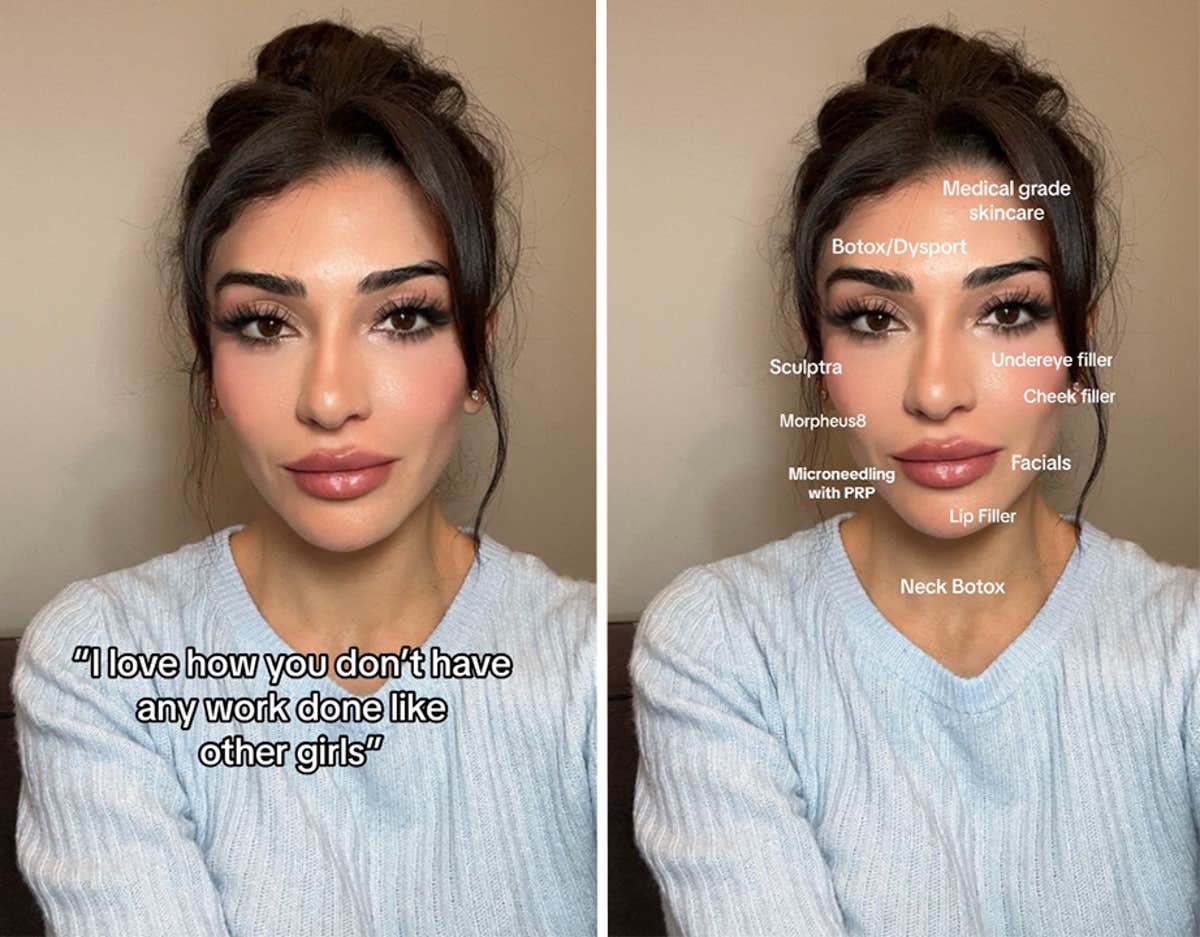 Gen Z Plastic Surgery Trends: Stigma Dies As Gen Z Embraces It