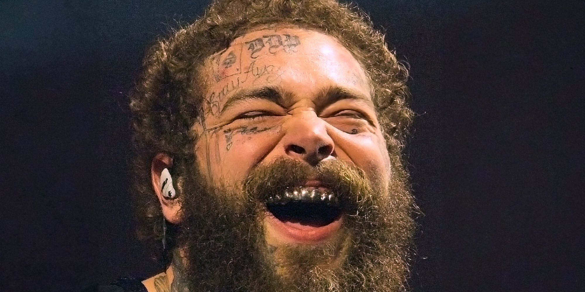 What's Going On With Post Malone's New Teeth?