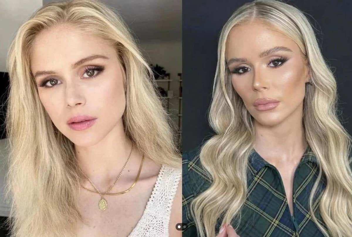 What Does 'Starlight Mogging' Mean?