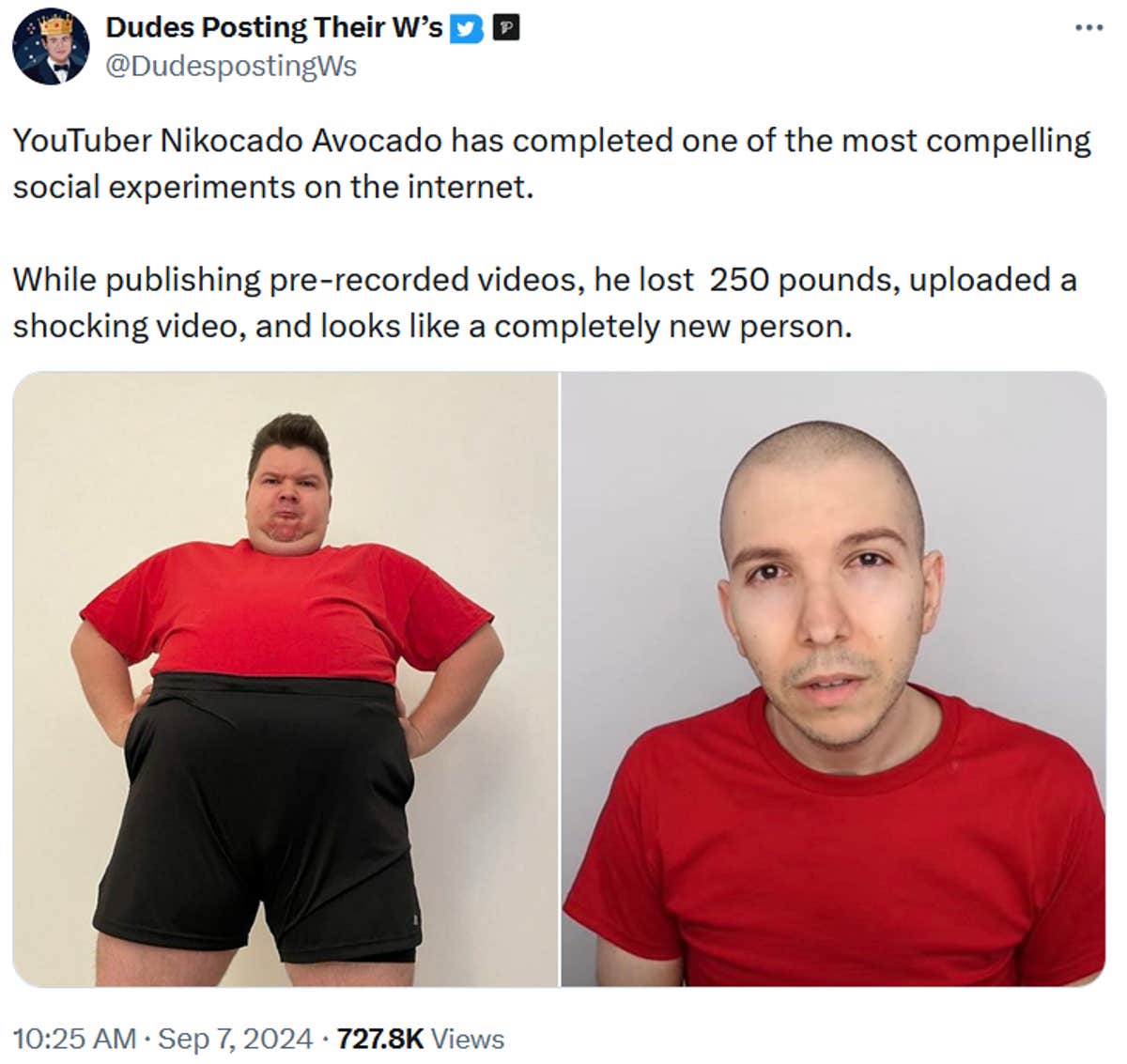 Nikocado Avocado Reveals Two-Year Transformation 'Experiment'