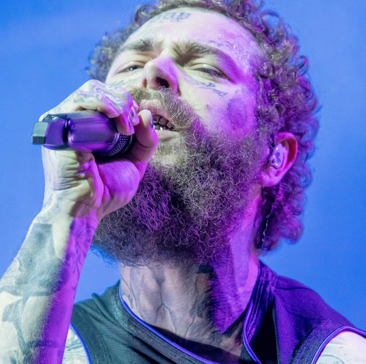 The secret of Post Malone's million-dollar teeth - News