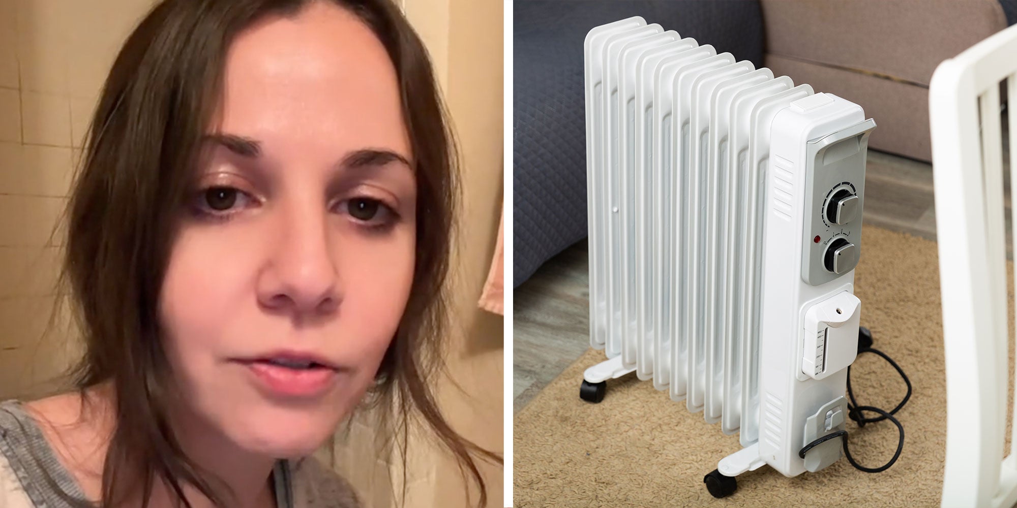 What Causes Toasted Skin Syndrome?