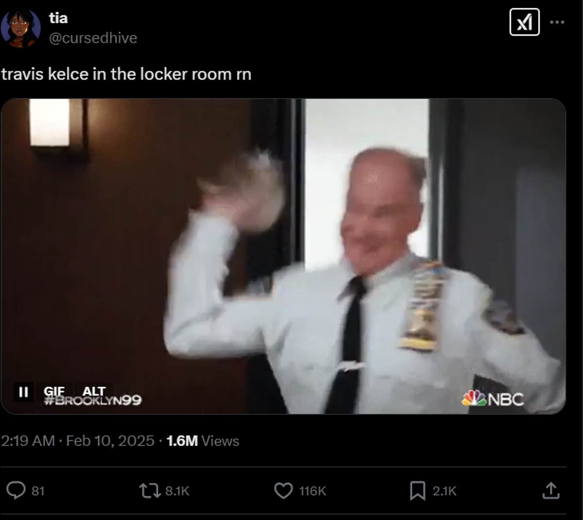 Travis Kelce’s hair sparks memes, trolling, and Super Bowl blame