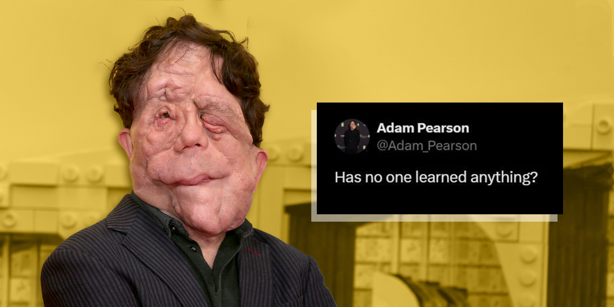 'Ableist Nonsense': Adam Pearson Claps Back At Hater Who Cal