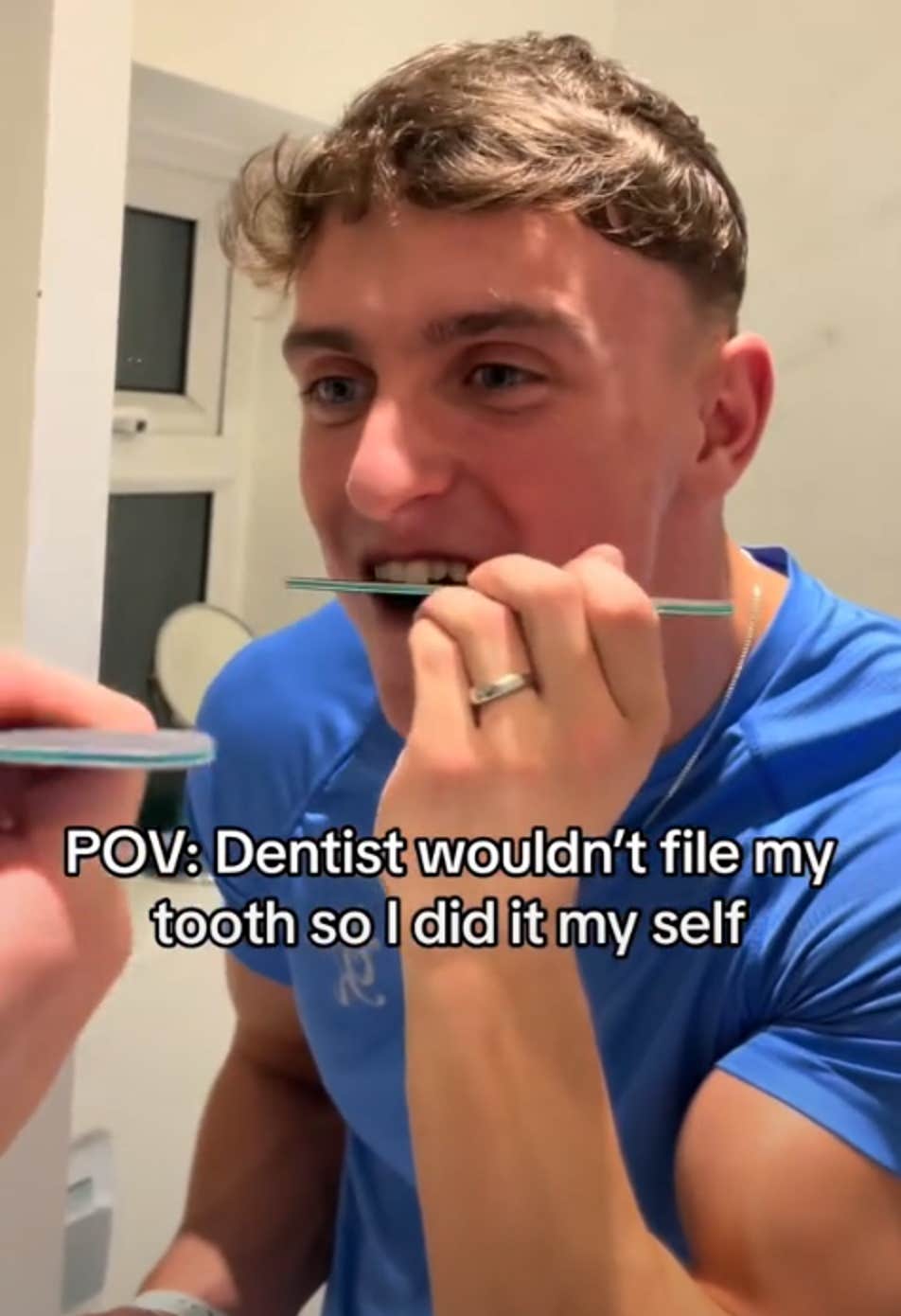 Aimee Lou Wood Hopes Fans Reject DIY Teeth Filing TikTok Trend