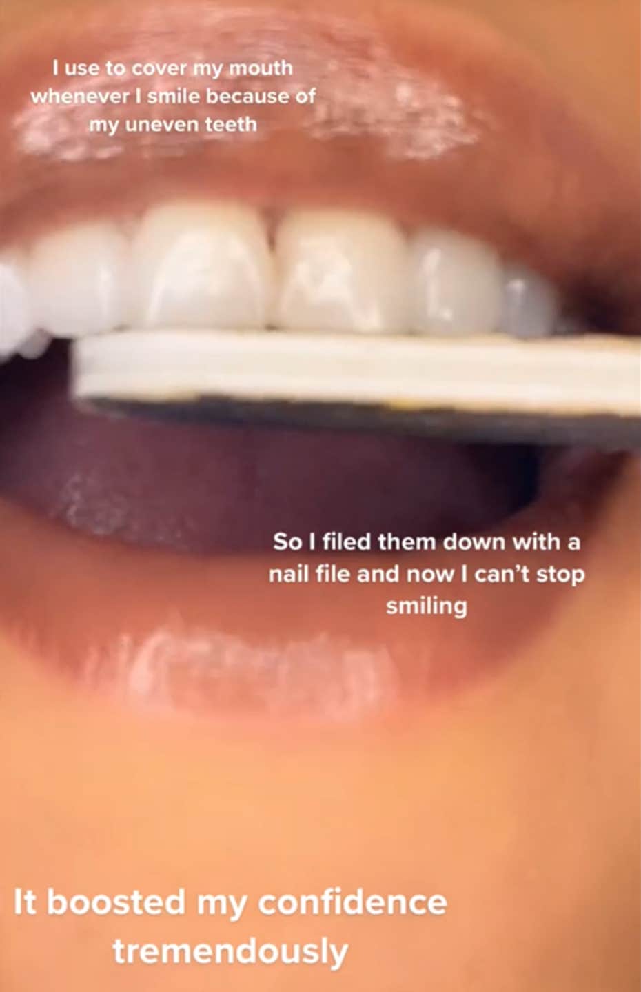 Aimee Lou Wood Hopes Fans Reject DIY Teeth Filing TikTok Trend