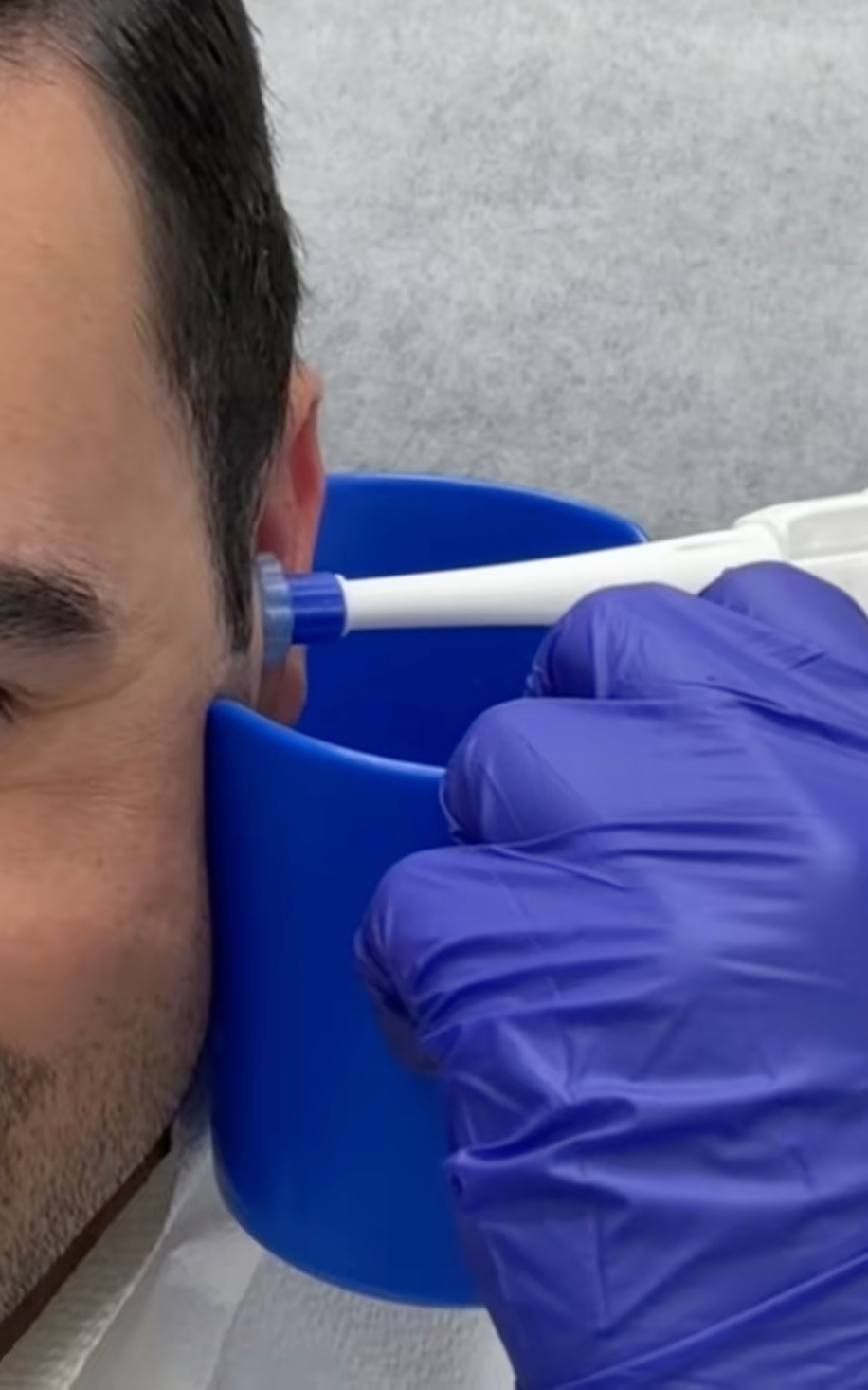 “Now I can hear everything”: People are horrified and fascinated to ...