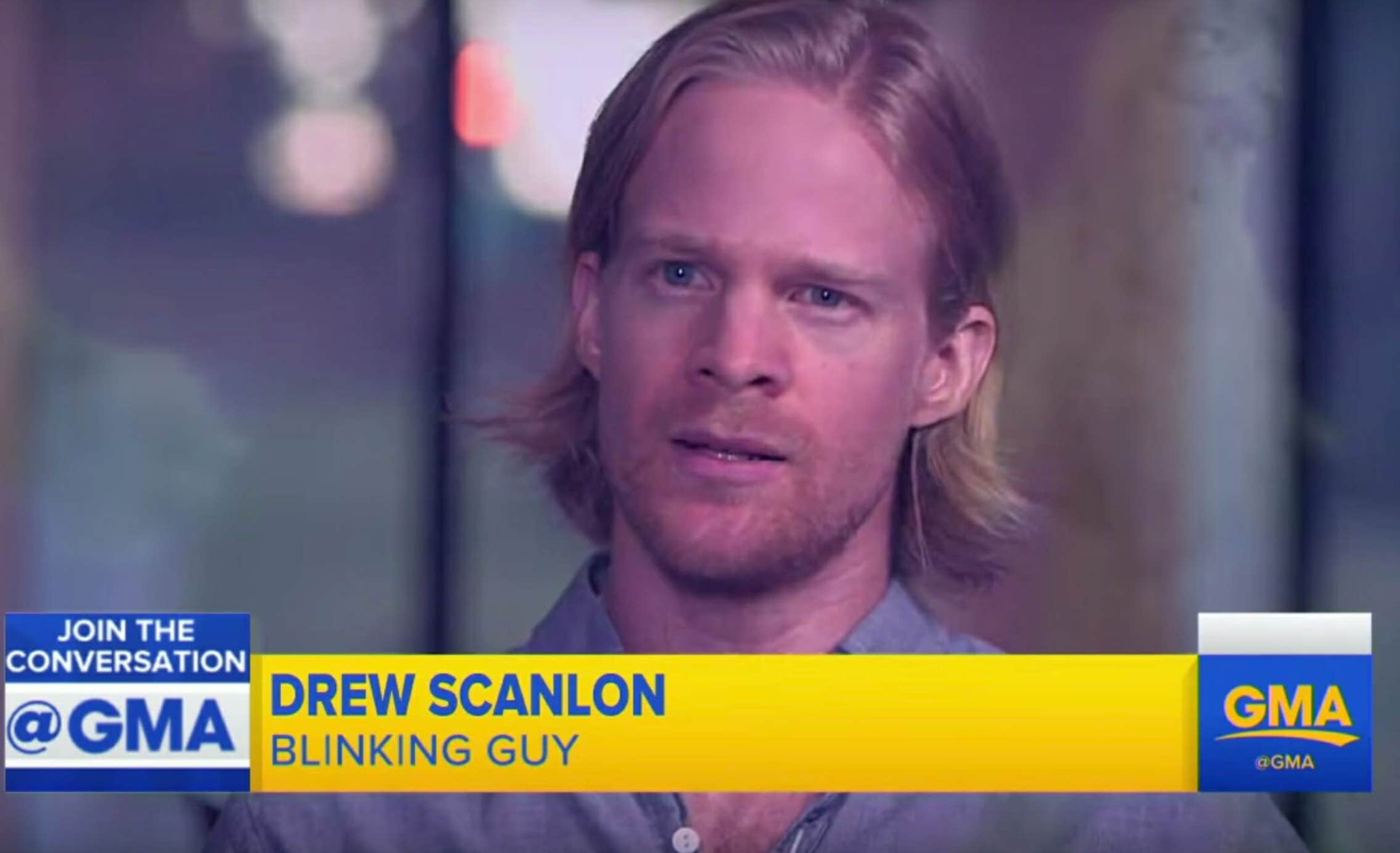 White Blinking Guy Practices New Blinks for TV