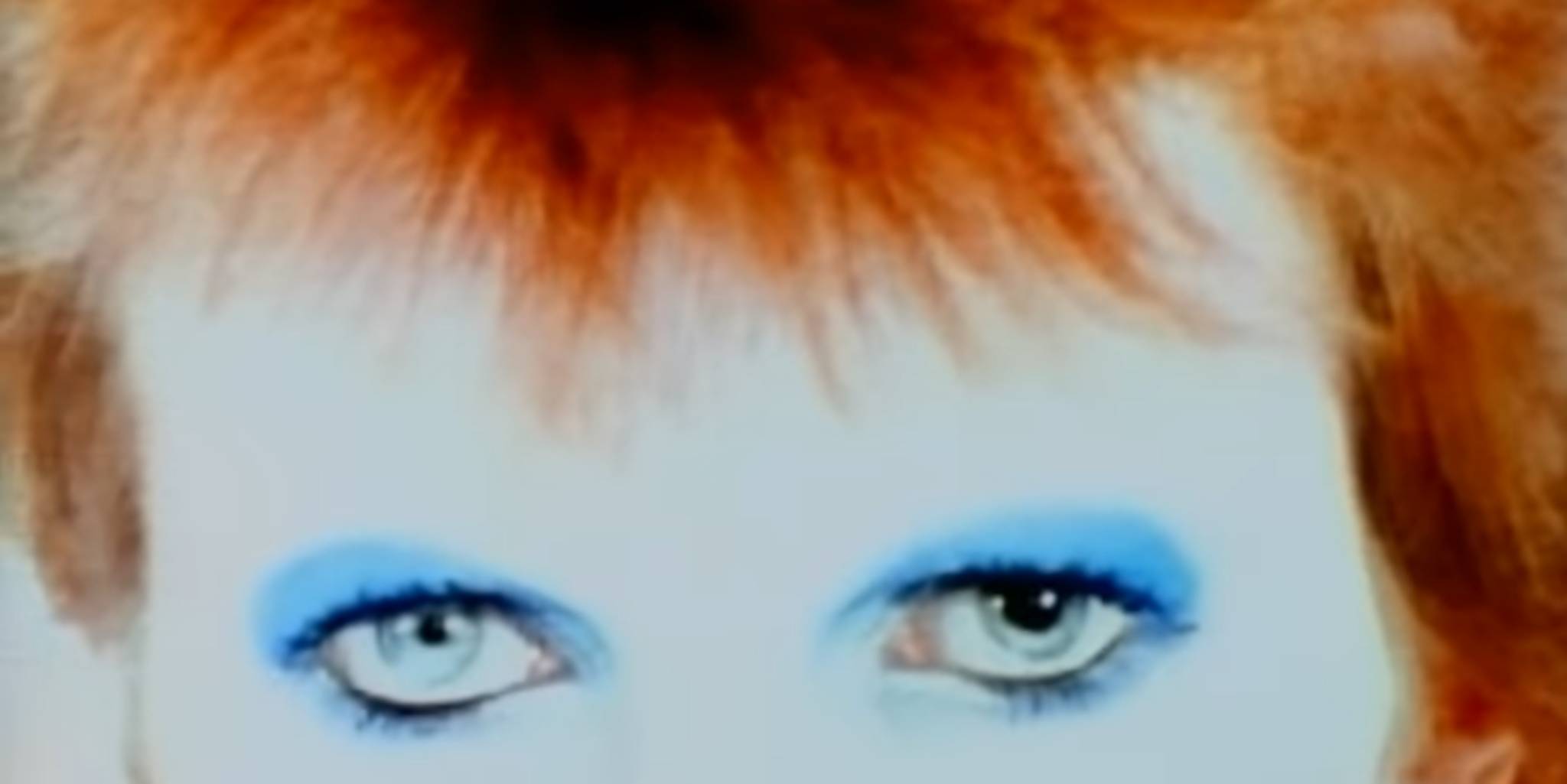 The Science Behind David Bowies Eyes