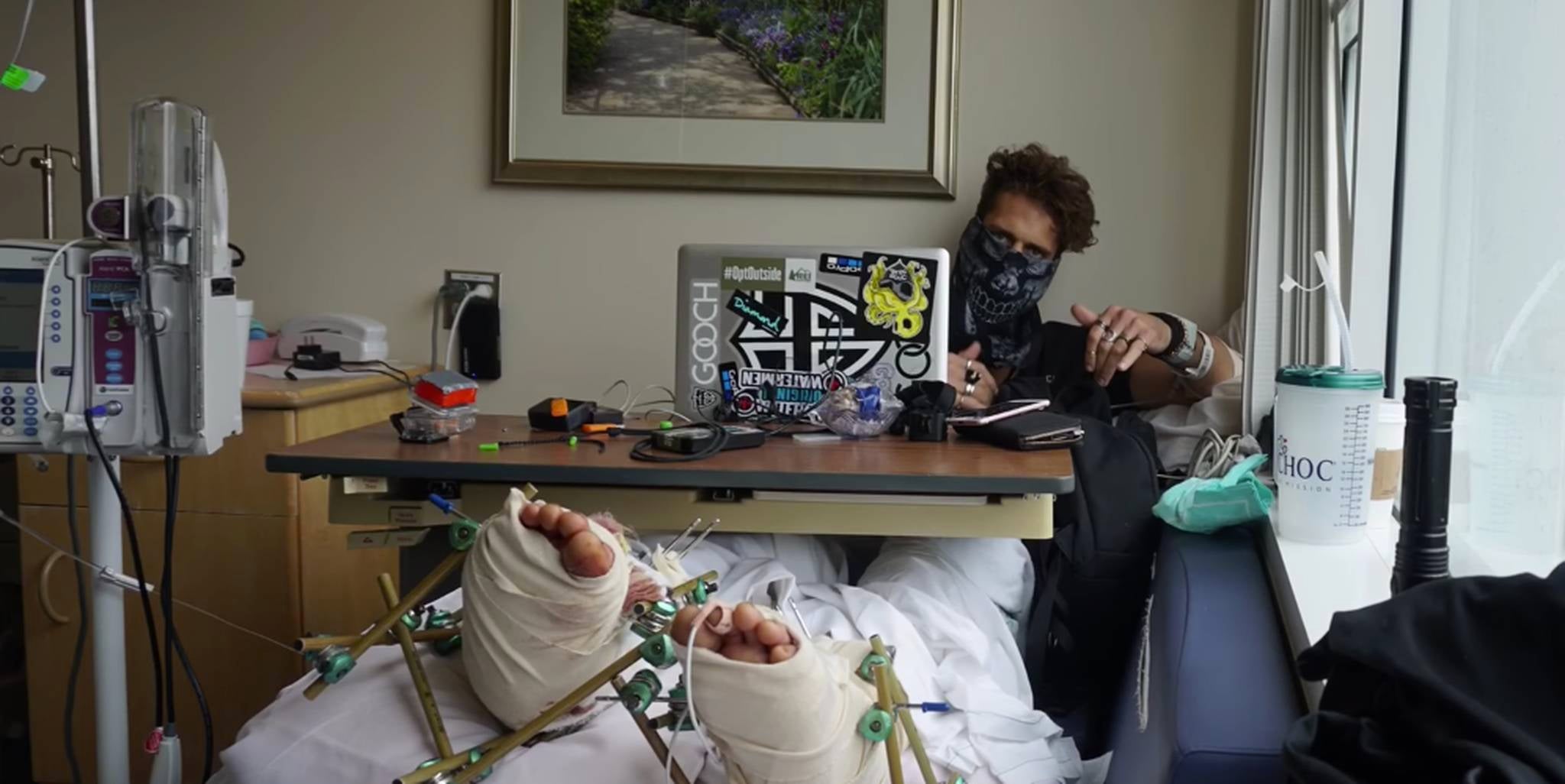 Internet Roasts YouTube Daredevil for Crowdfunding to Pay for Botched Stunt